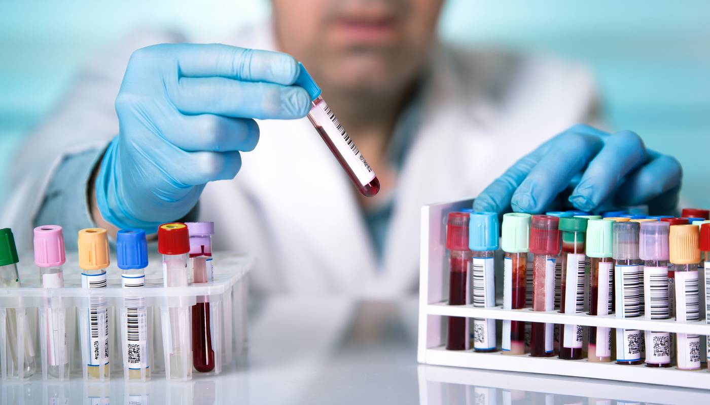 ThromboExact S-Monovette | Endokrinologikum Labore Hamburg