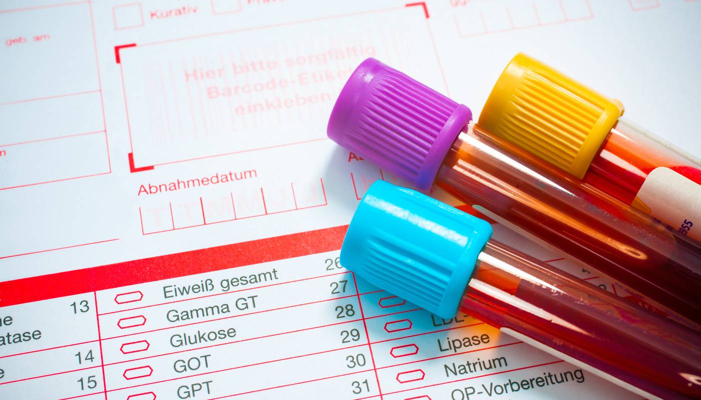 Dihydrotestosteron | Endokrinologikum Labore Hamburg